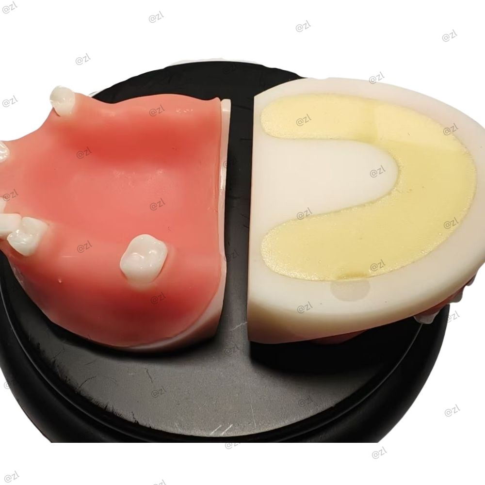 Upper Jaw Dental Implant Training Model with Soft Gum and Partial Teeth