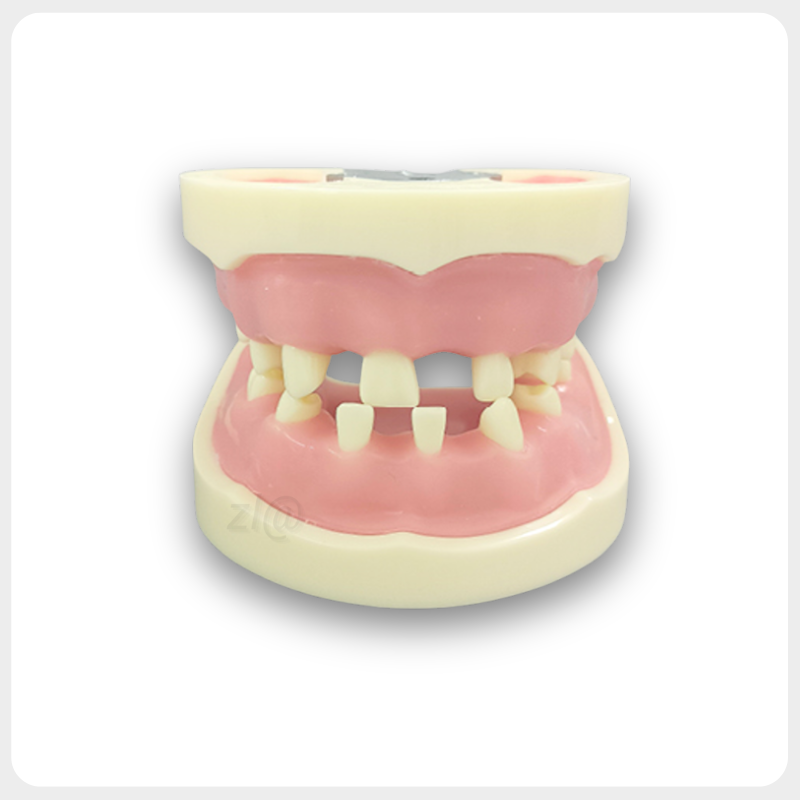 Dental Implant Training Model with Standard and Radiopaque Teeth for ...