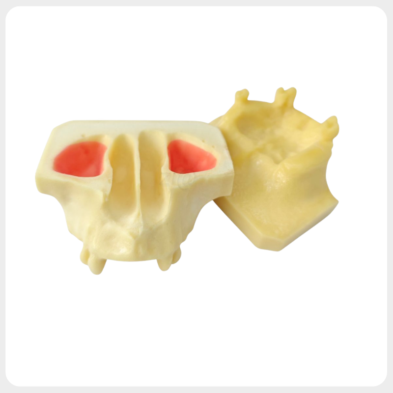 Maxillary Sinus Model for Dental Implant Practice – ZL-DT15414A